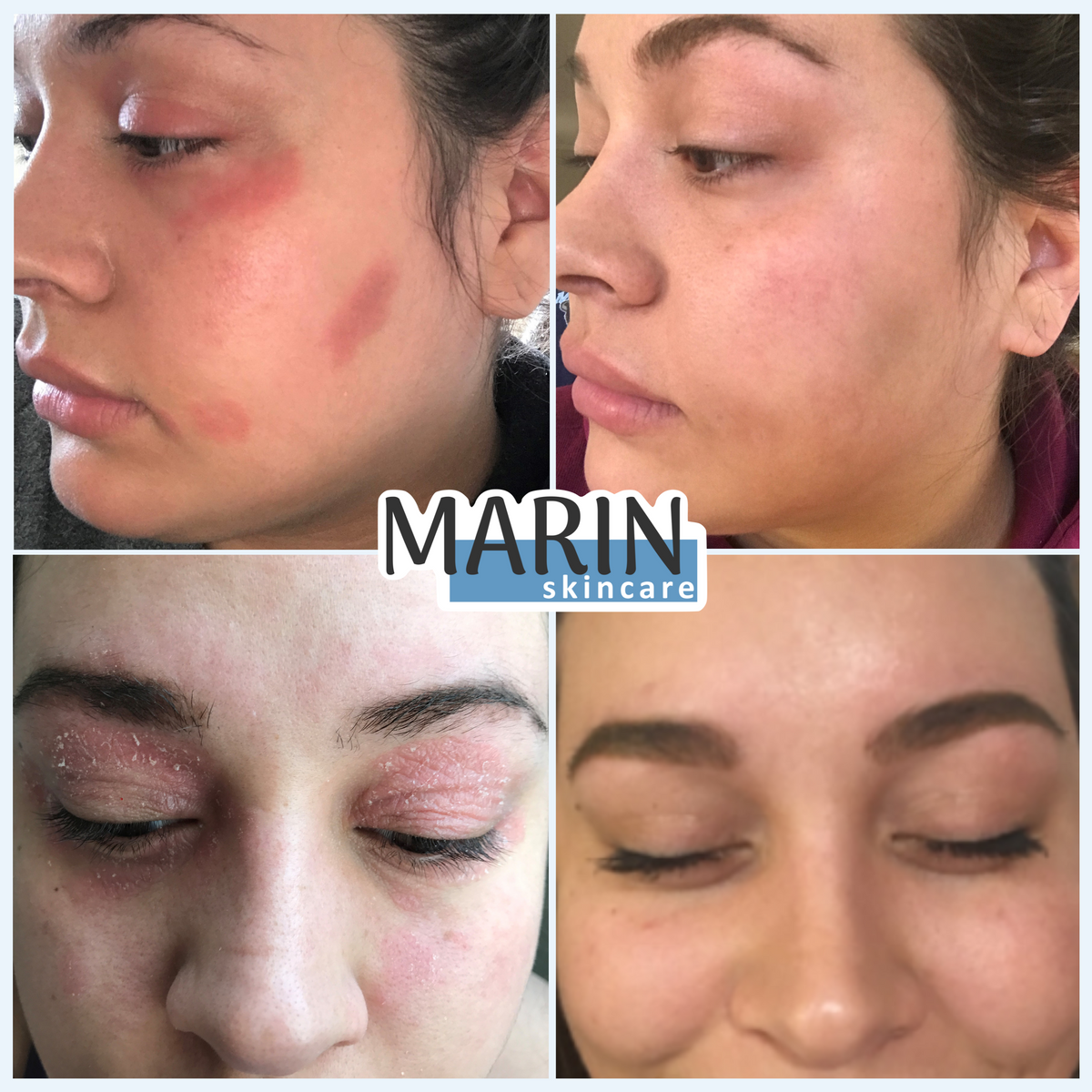 Amber's Story – Marin Skincare